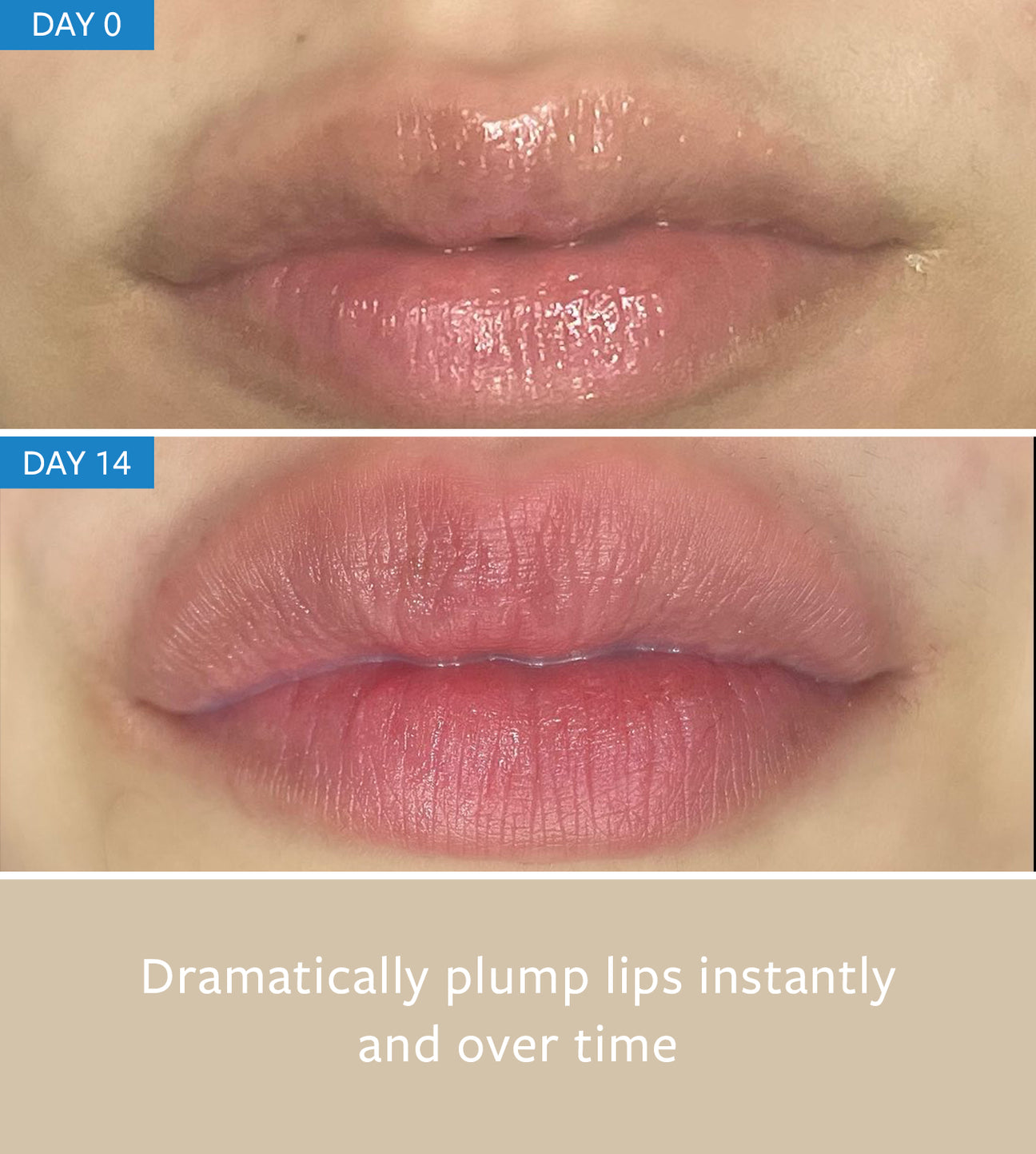 LIP INJECTION 10ml - Freeze Frame – freezeframe-uk