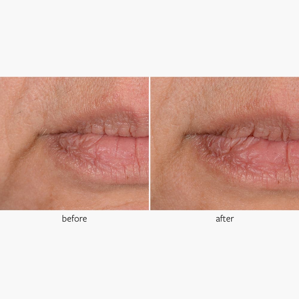 WRINKLE BLOCK 30g - Freeze Frame – freezeframe-uk